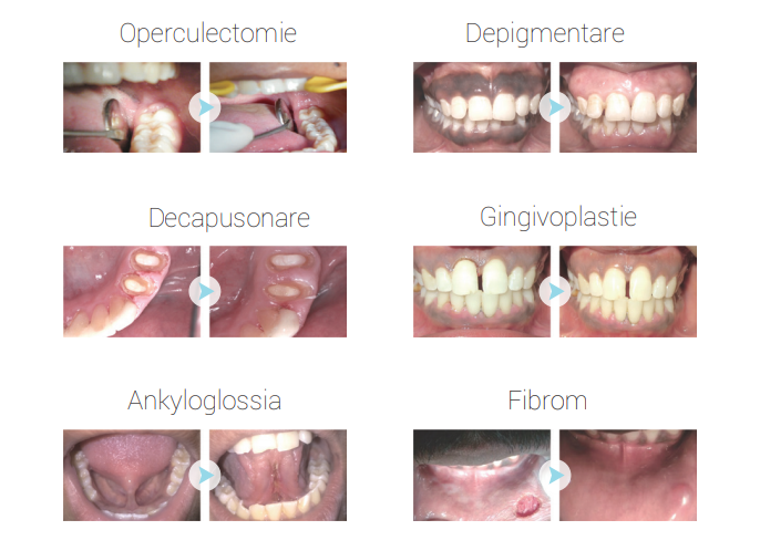 Cabinet stomatologic Dentonic Popesti Leordeni - DENTONIC